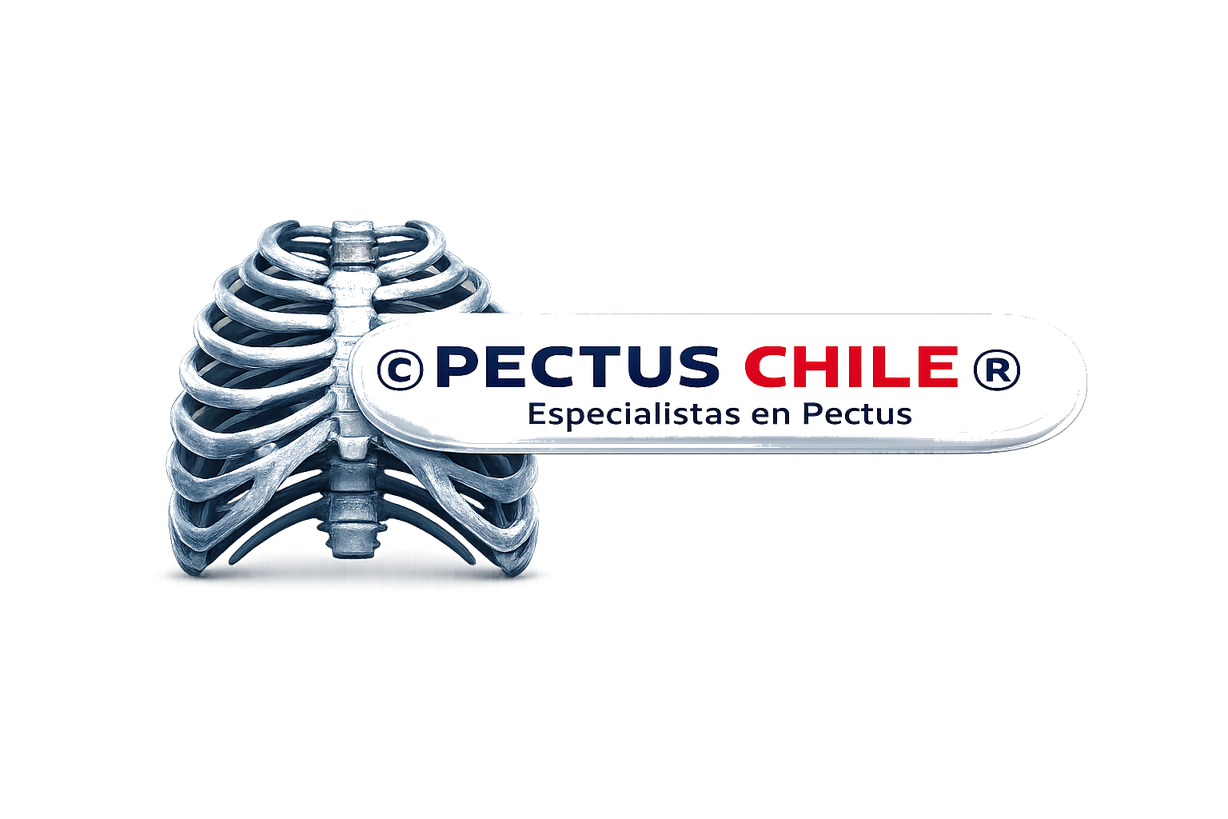 PECTUS EXCAVATUM - PECTUS CHILE